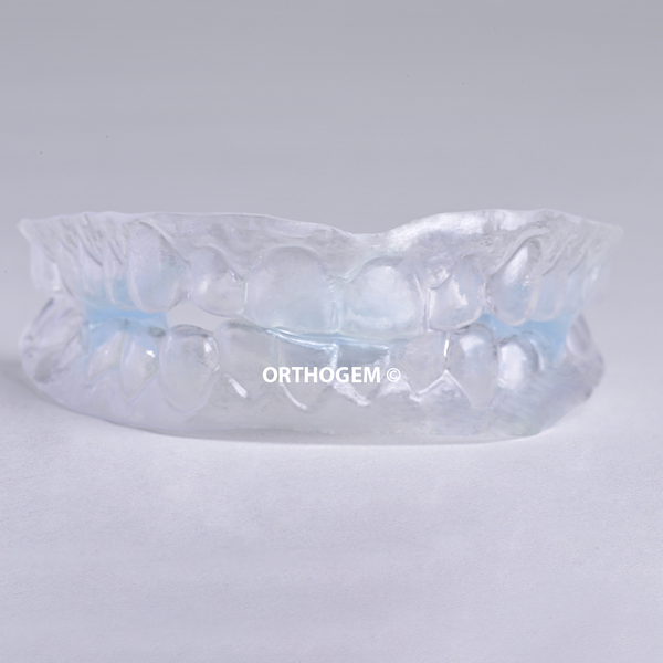 Damon Splint – orthogem-lab